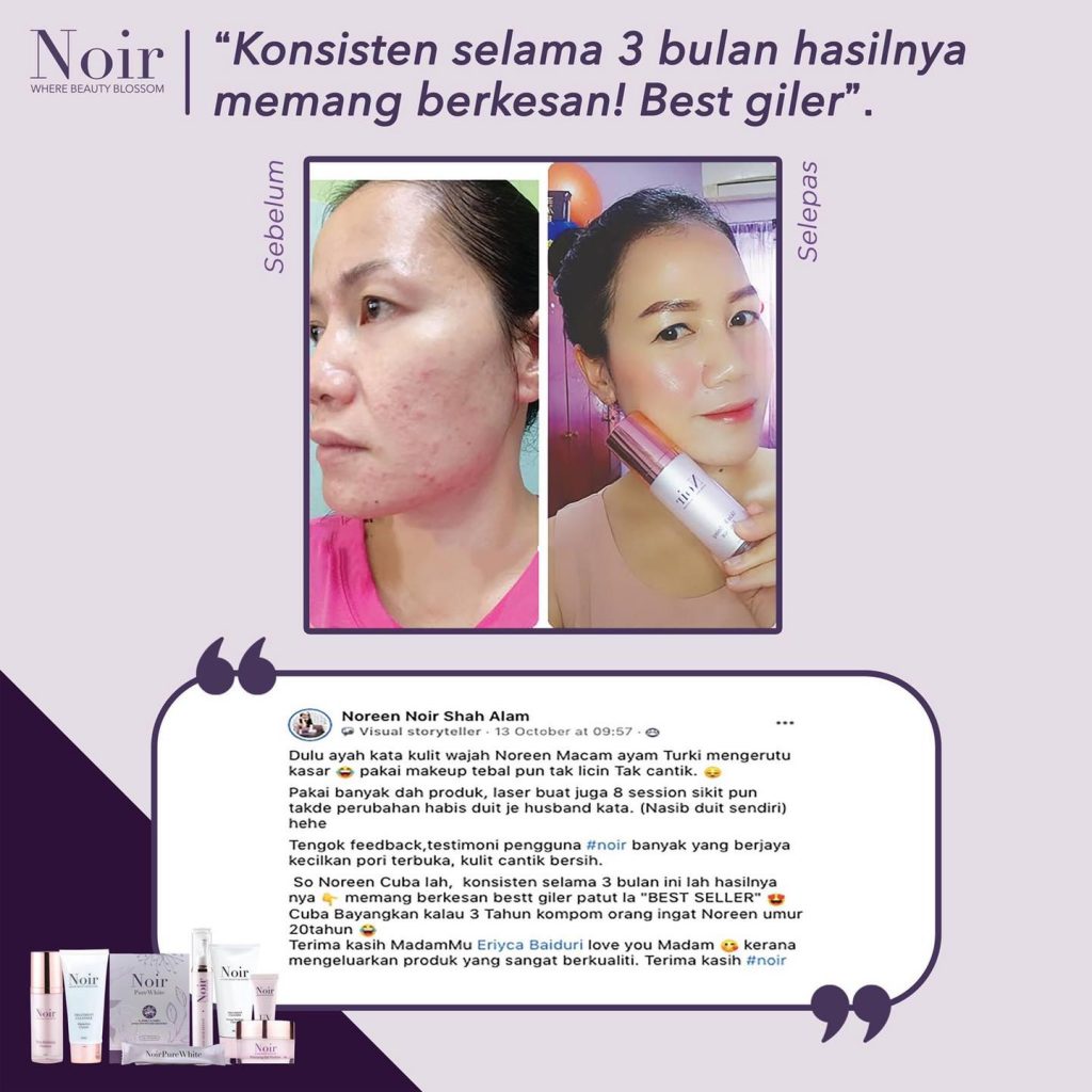 Noir Skincare Testimoni - Noir Skincare Review - Noir Skincare Testimoni